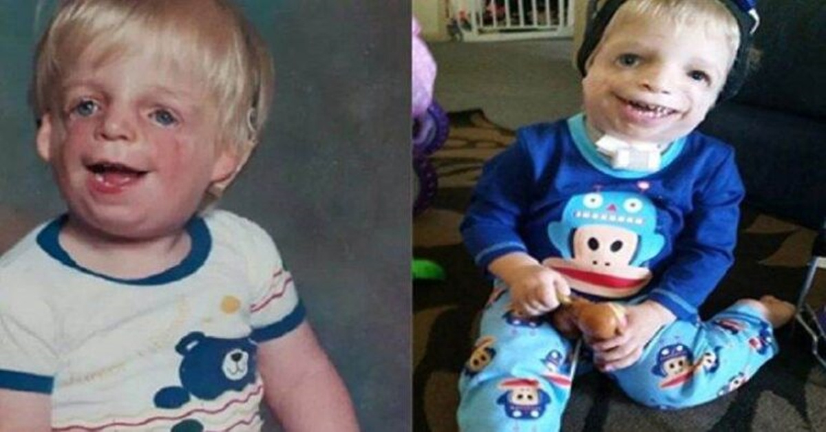 A história do menino que foi abandonado por ser ‘feio demais’ e adotado ...