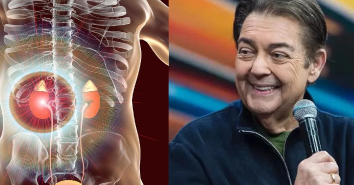 Transplante de rim: Como é feito o procedimento cirúrgico realizado por ...